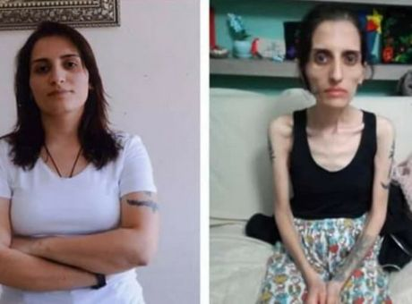 Φ Α Σ Ι Σ Μ Ο Σ 288 ημερών, αιώνες α μ ε τ α ν ό η τ ο ς ''Κορωνοϊός''!