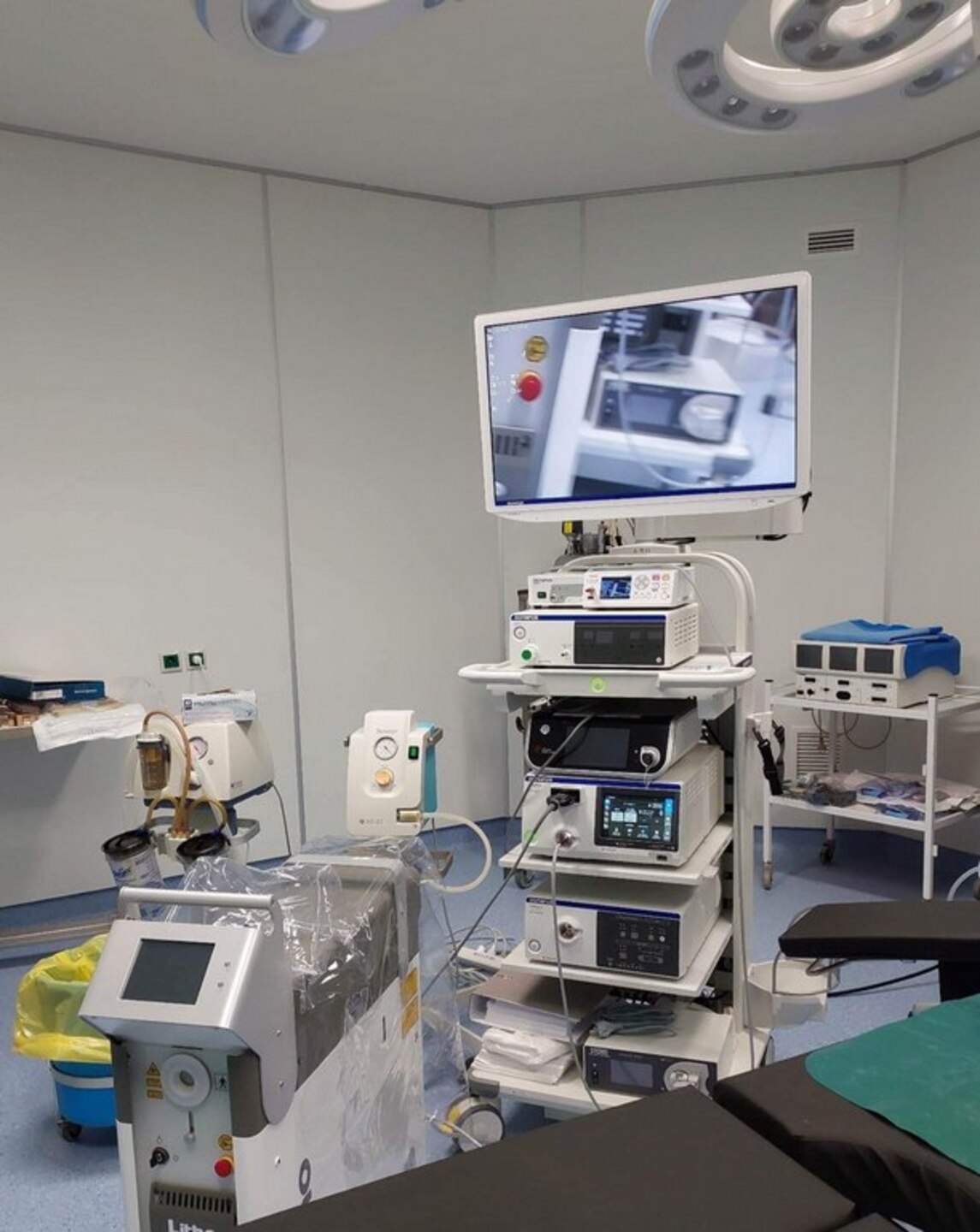 Νέα ψηφιακά ακτινολογικά μηχανήματα στο Νοσοκομείο Βέροιας